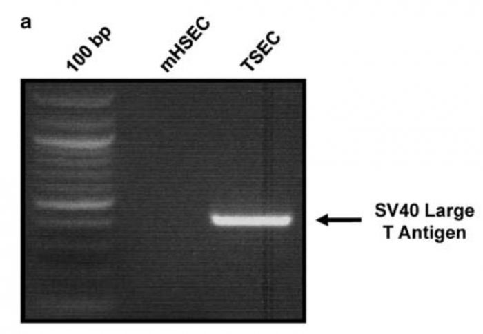 Immortalized Mouse Hepatic Sinusoidal Endothelial Cells - SV40