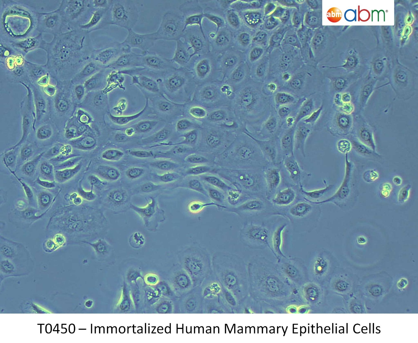 Immortalized Human Mammary Epithelial Cells