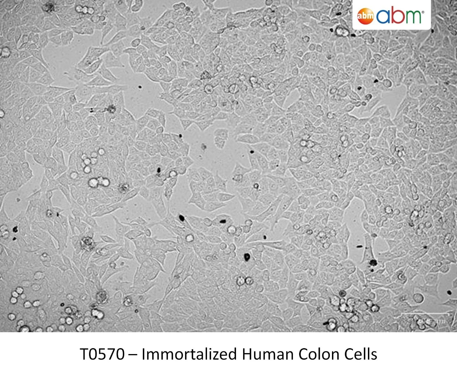 Immortalized Human Colon Cells